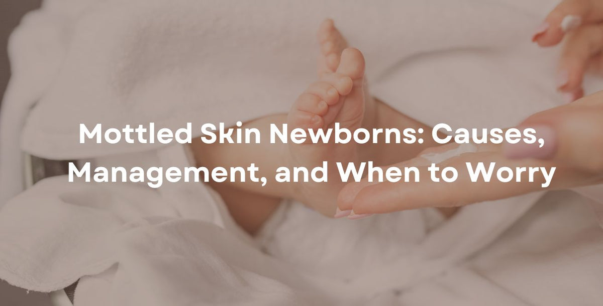 Mottled Skin Newborns: Causes & Care